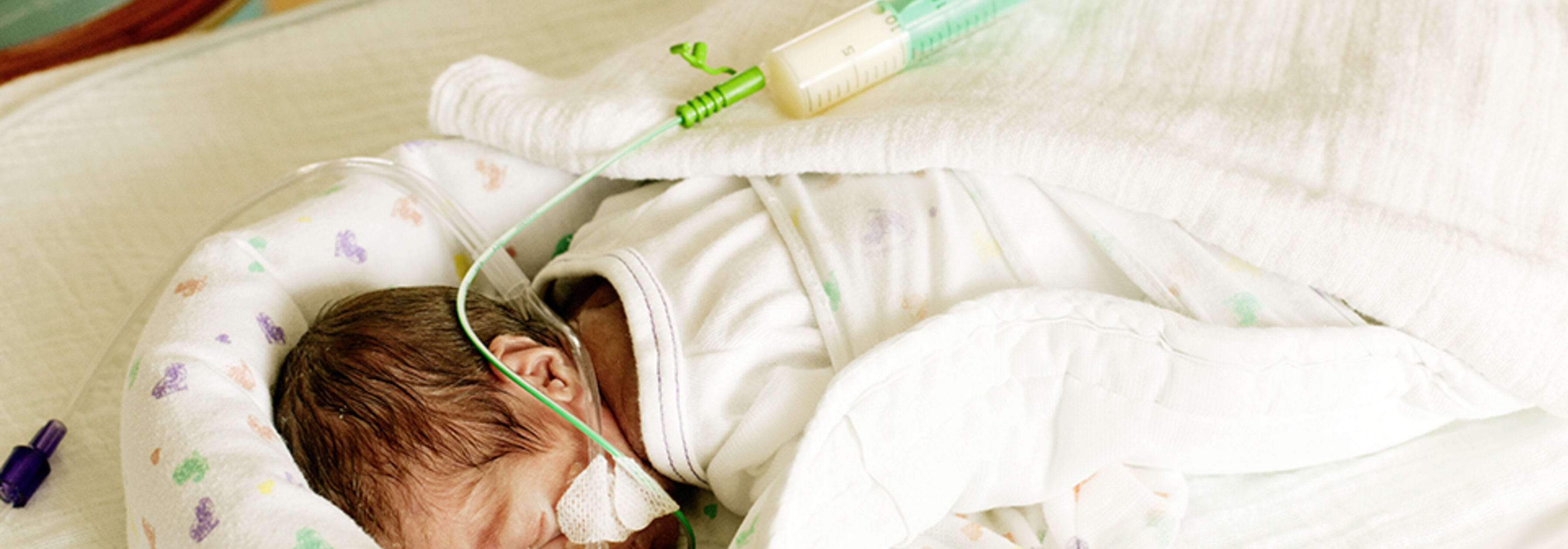 Feeding Solutions for Special Needs Babies | Medela