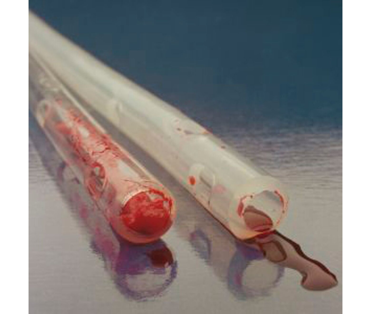 Catéteres Axiom® Atraum® revestidos con ClotStop®