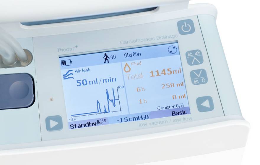Advancing patient recovery with digital chest drainage systems